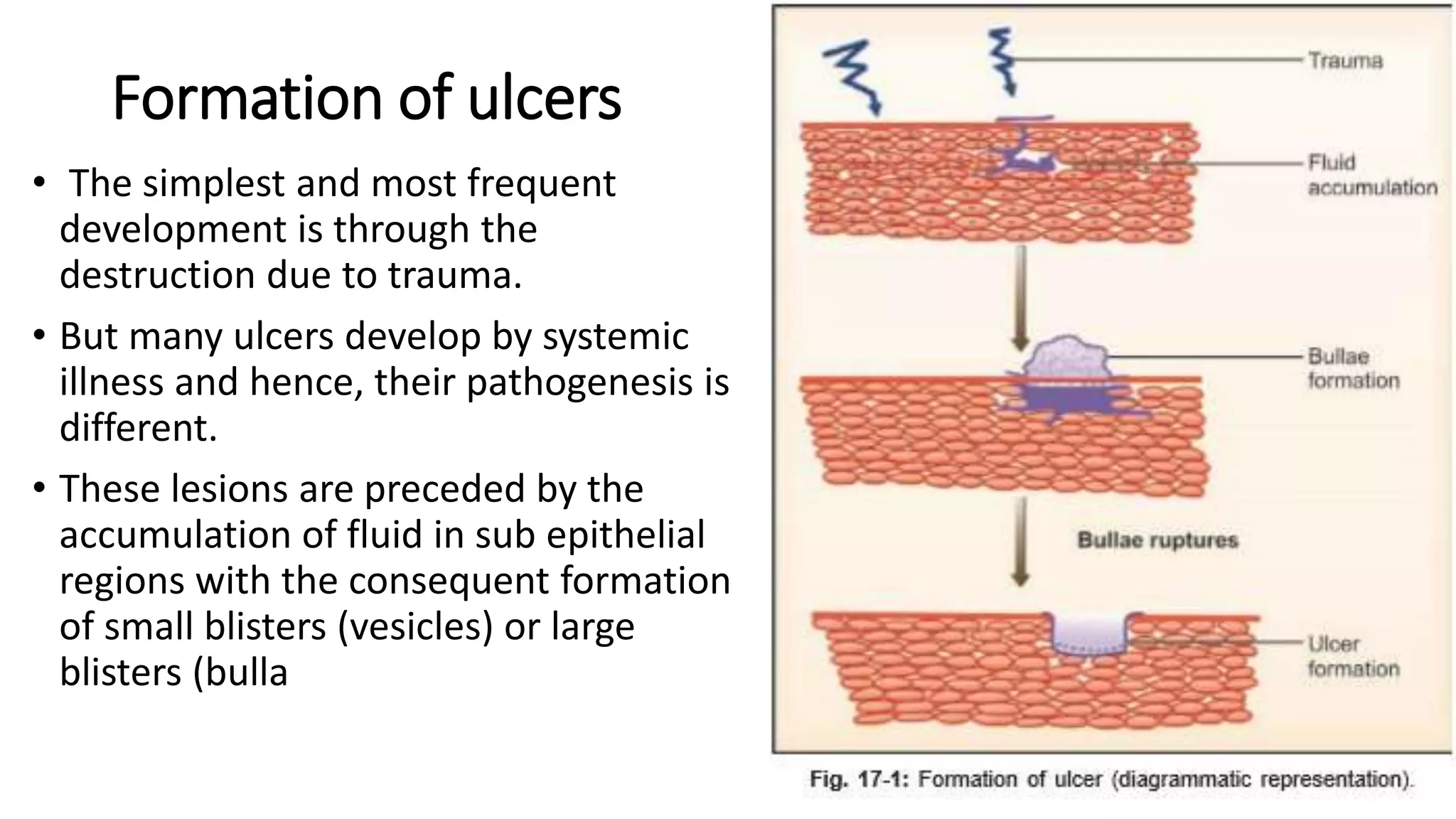 Ulcerative, Vesicular and Bullous Lesions.pptx