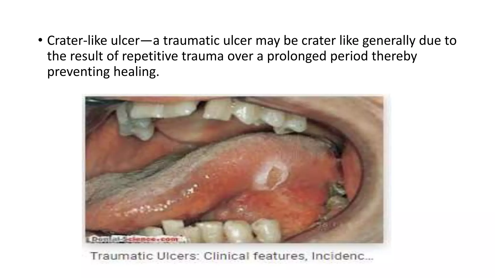 Ulcerative, Vesicular and Bullous Lesions.pptx