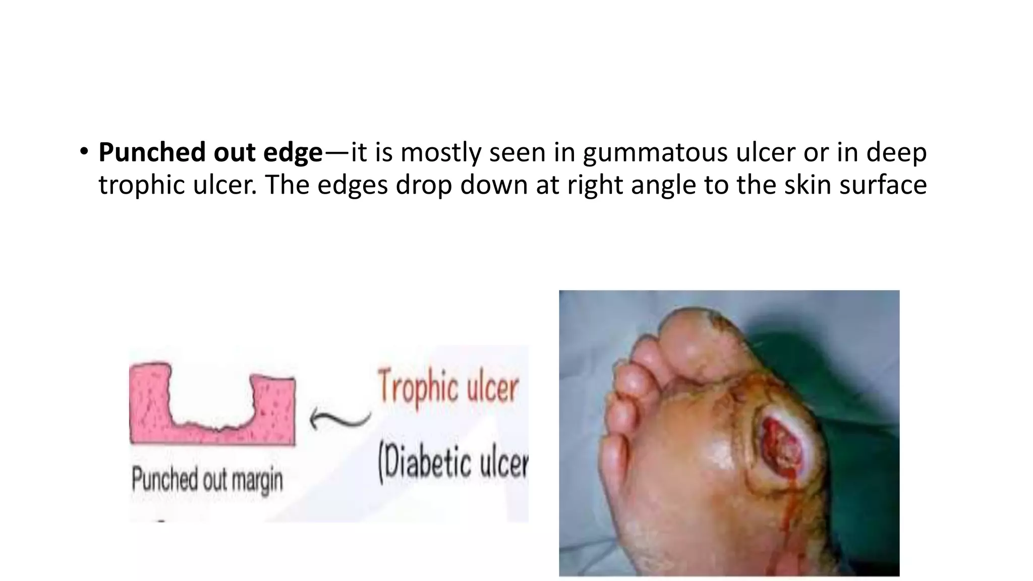Ulcerative, Vesicular and Bullous Lesions.pptx