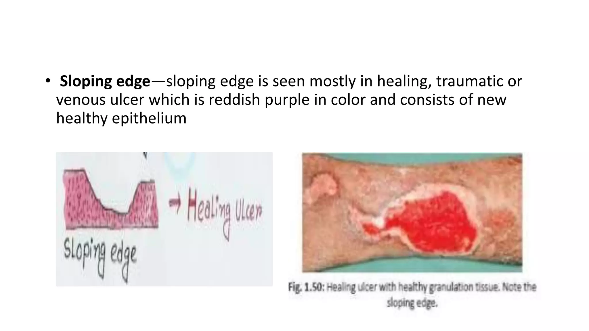 Ulcerative, Vesicular and Bullous Lesions.pptx