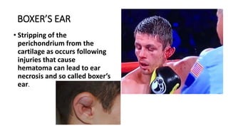 ANATOMY OF EAR.pptx