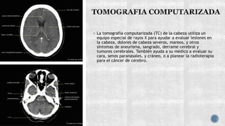 1.3 Estructura de cráneo y métodos de imagen.pdf