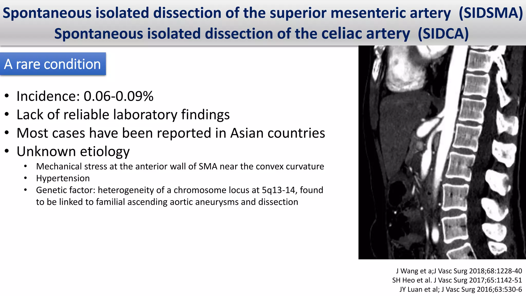 2023-06 Vietnam SMA dissection.pdf