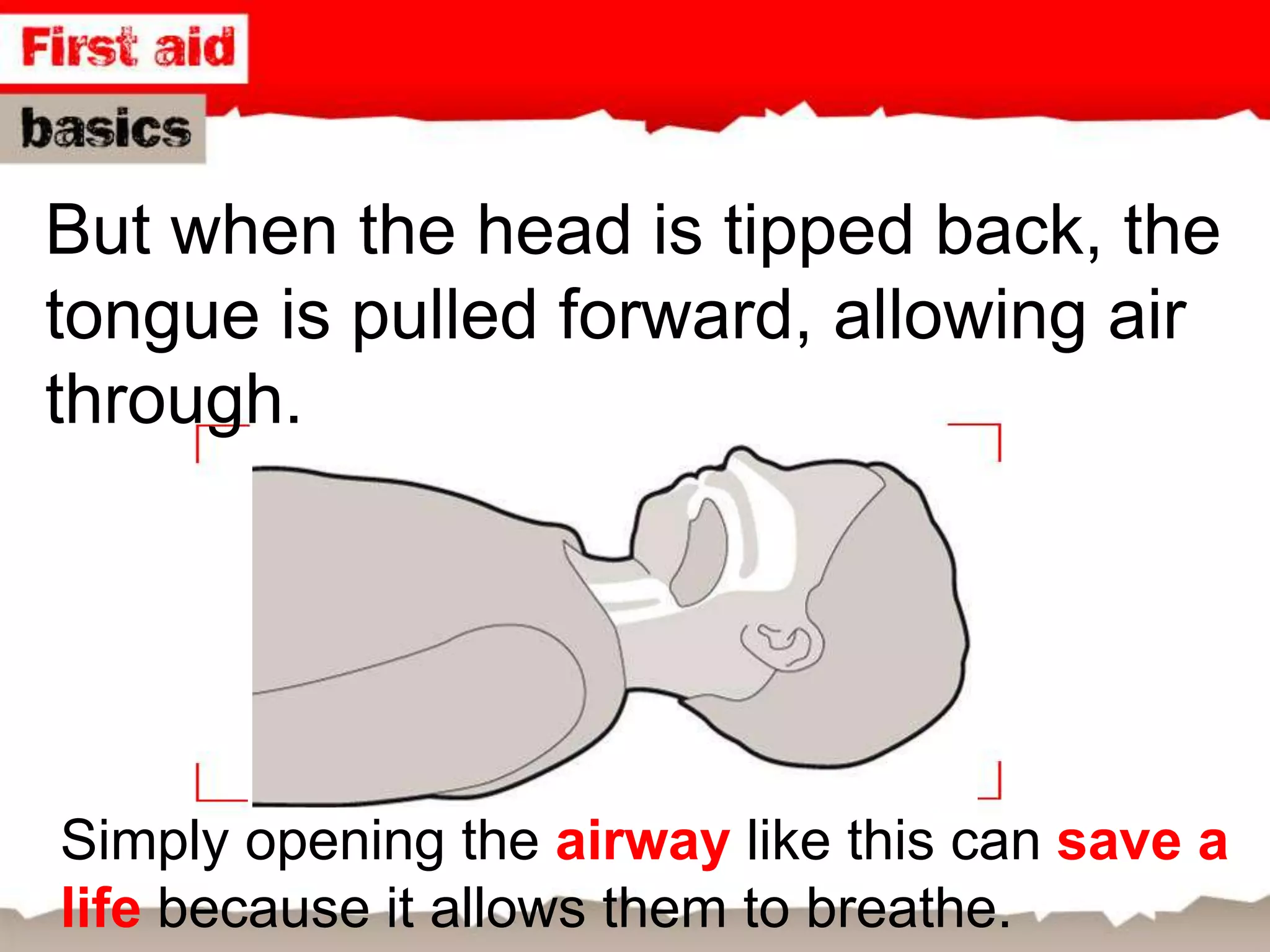 Basic First Aid for Grade 9 | PPT