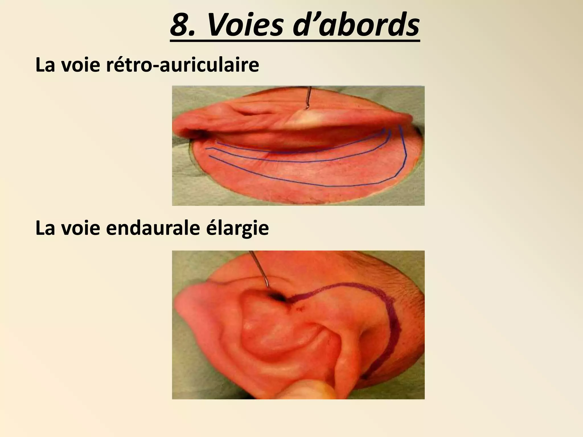 anatomie de la Mastoïde | PPT