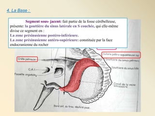 anatomie de la Mastoïde | PPTX