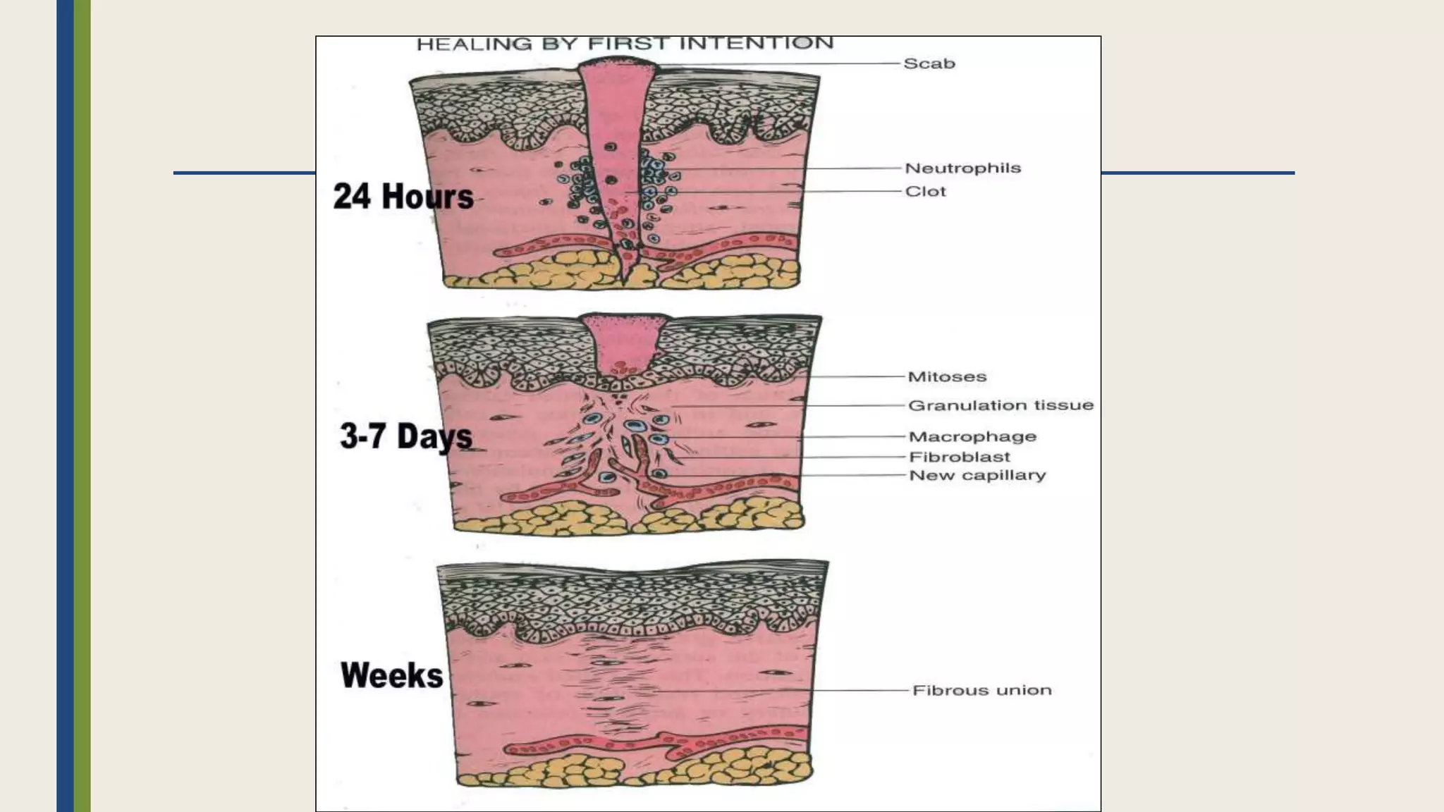 Inflammation & Healing.pptx