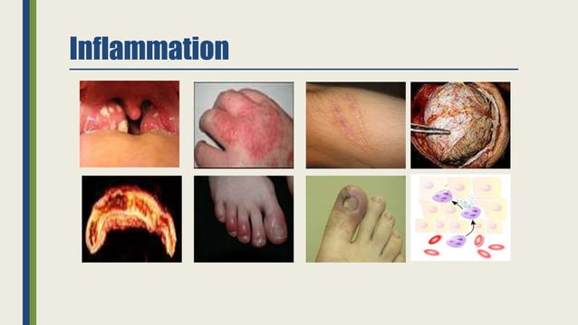 Inflammation & Healing.pptx