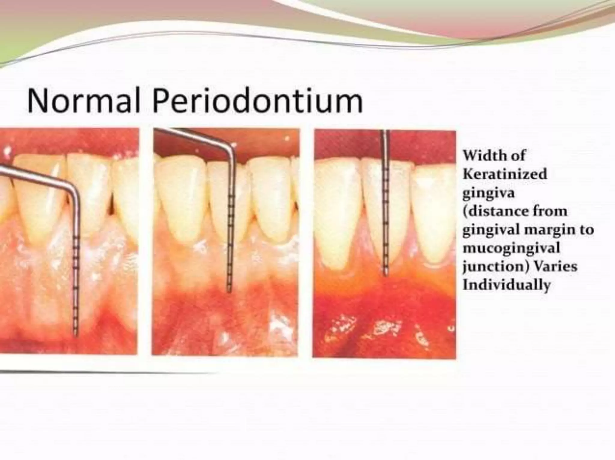 1.introduction to periodontics.pptx