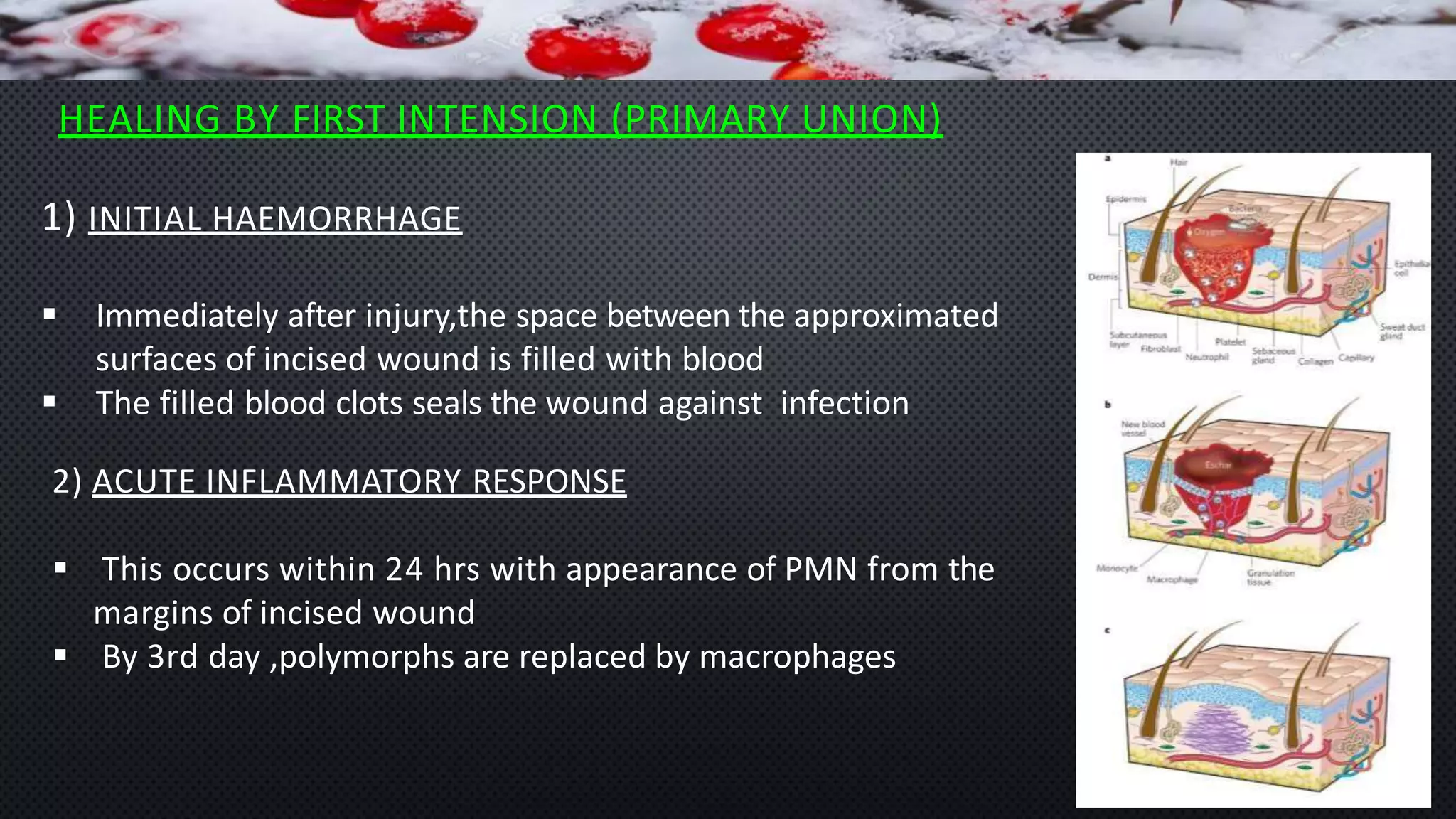 1.2 Inflammation & wound healing.pptx