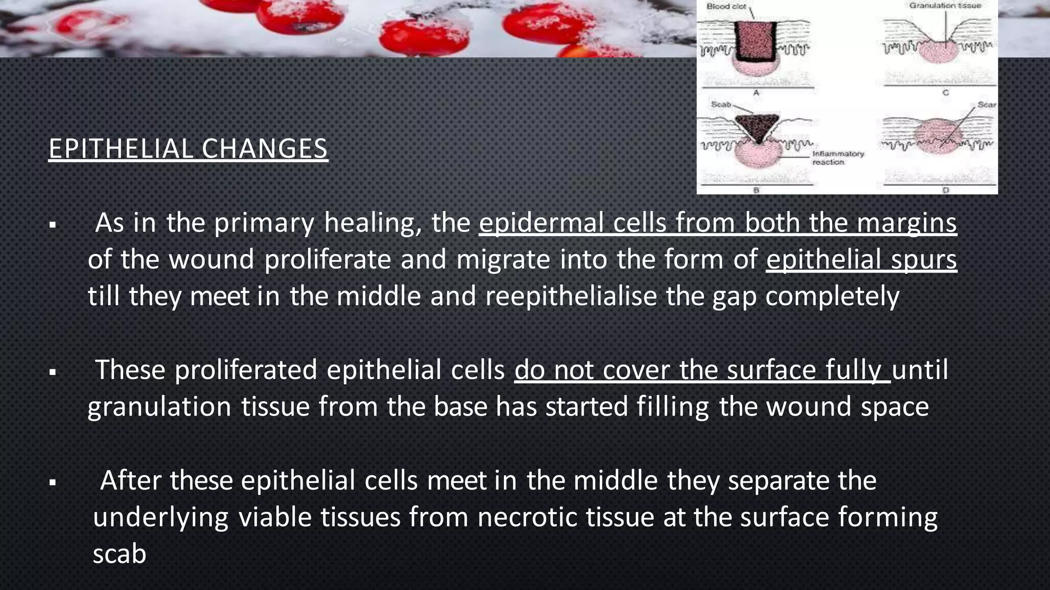 1.2 Inflammation & wound healing.pptx