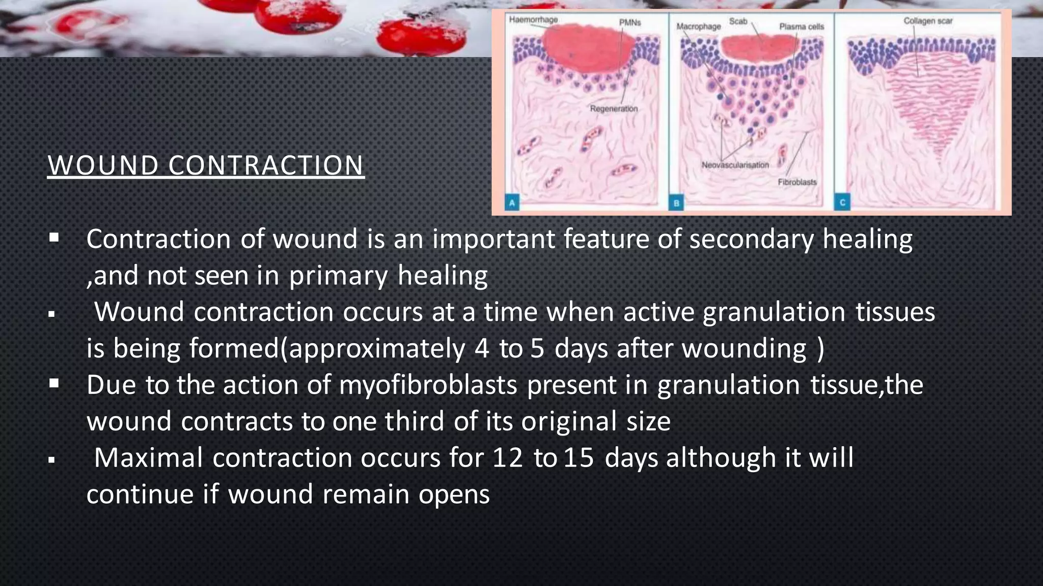 1.2 Inflammation & wound healing.pptx