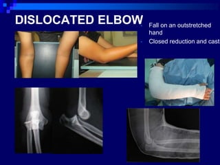1. CONCEPT INJURY MUSCULOSCELETAL.pptx