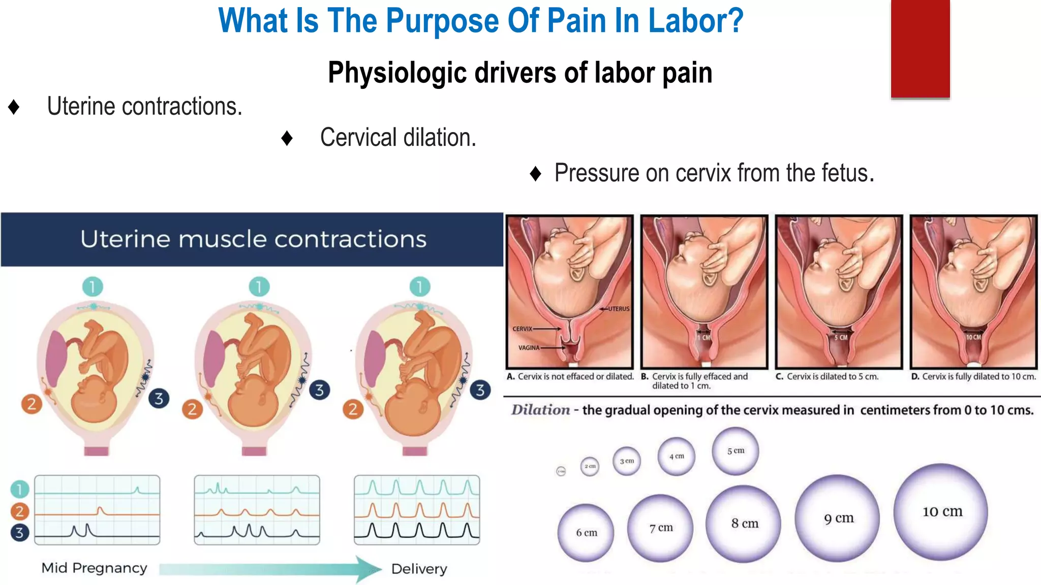 PAIN MANAGEMENT DURING LABOR AND DELIVERY.pptx