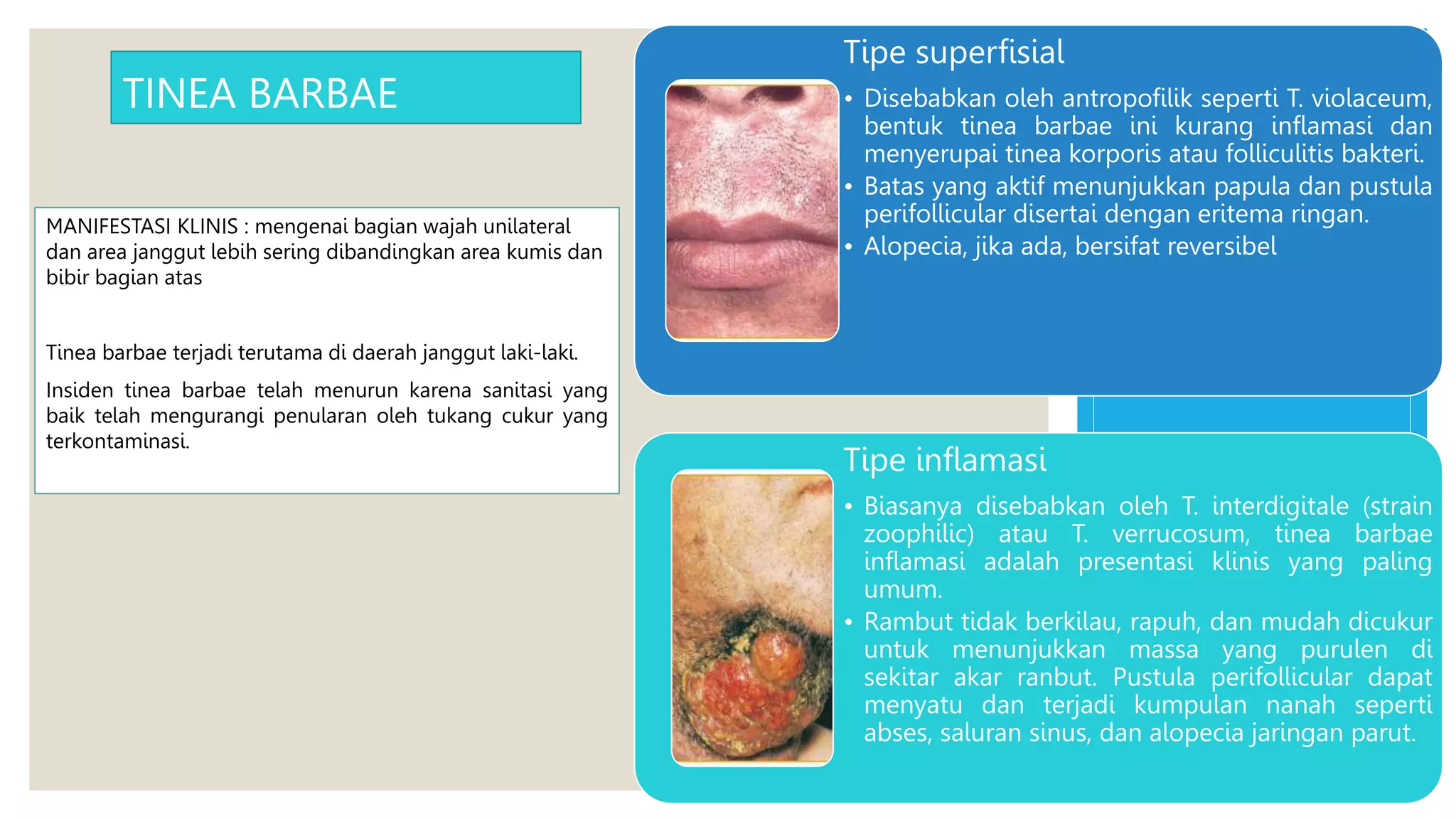1. Dermatofitosis (1).pptx