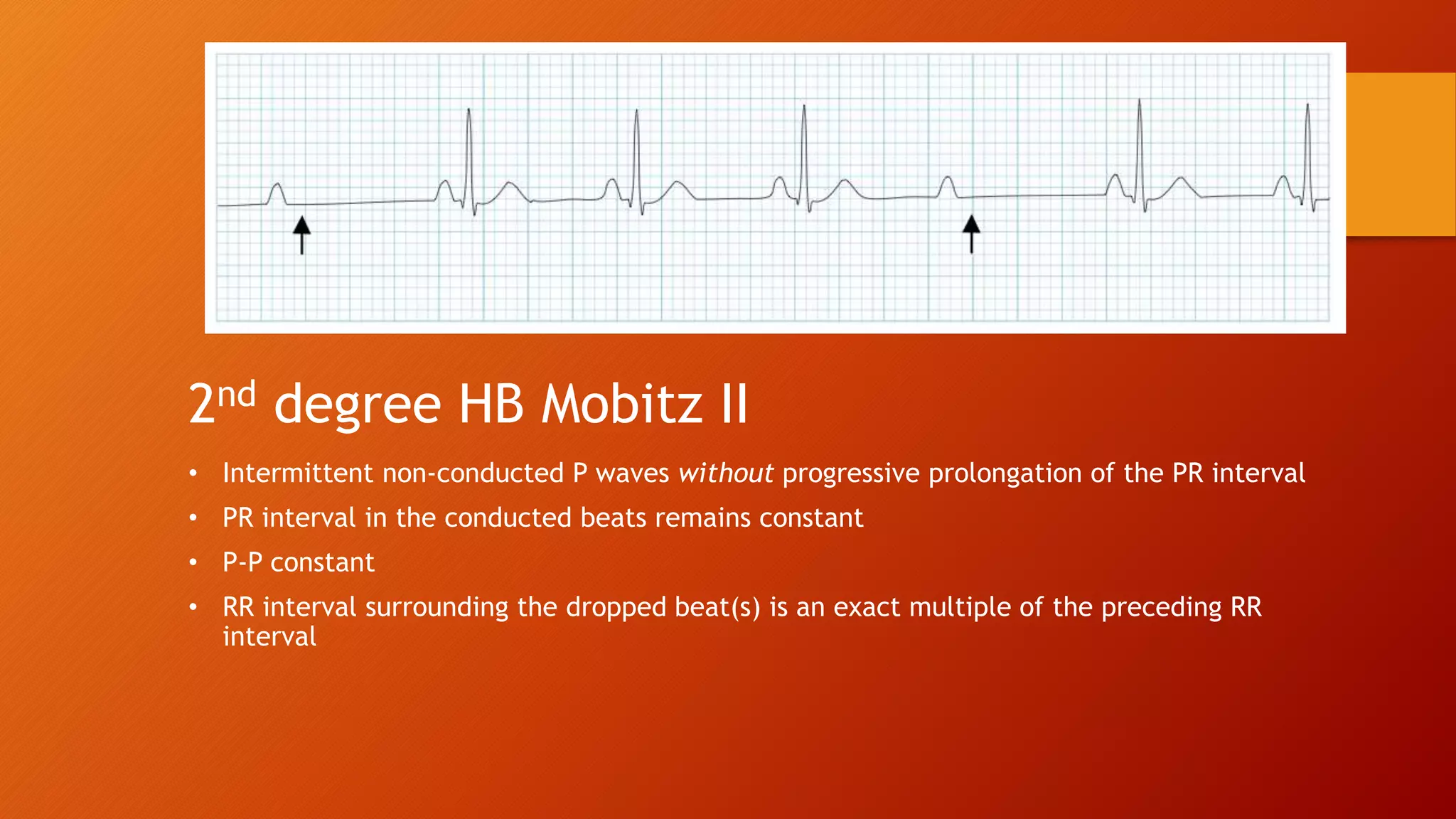 1.Rhythm Recognition.pptx