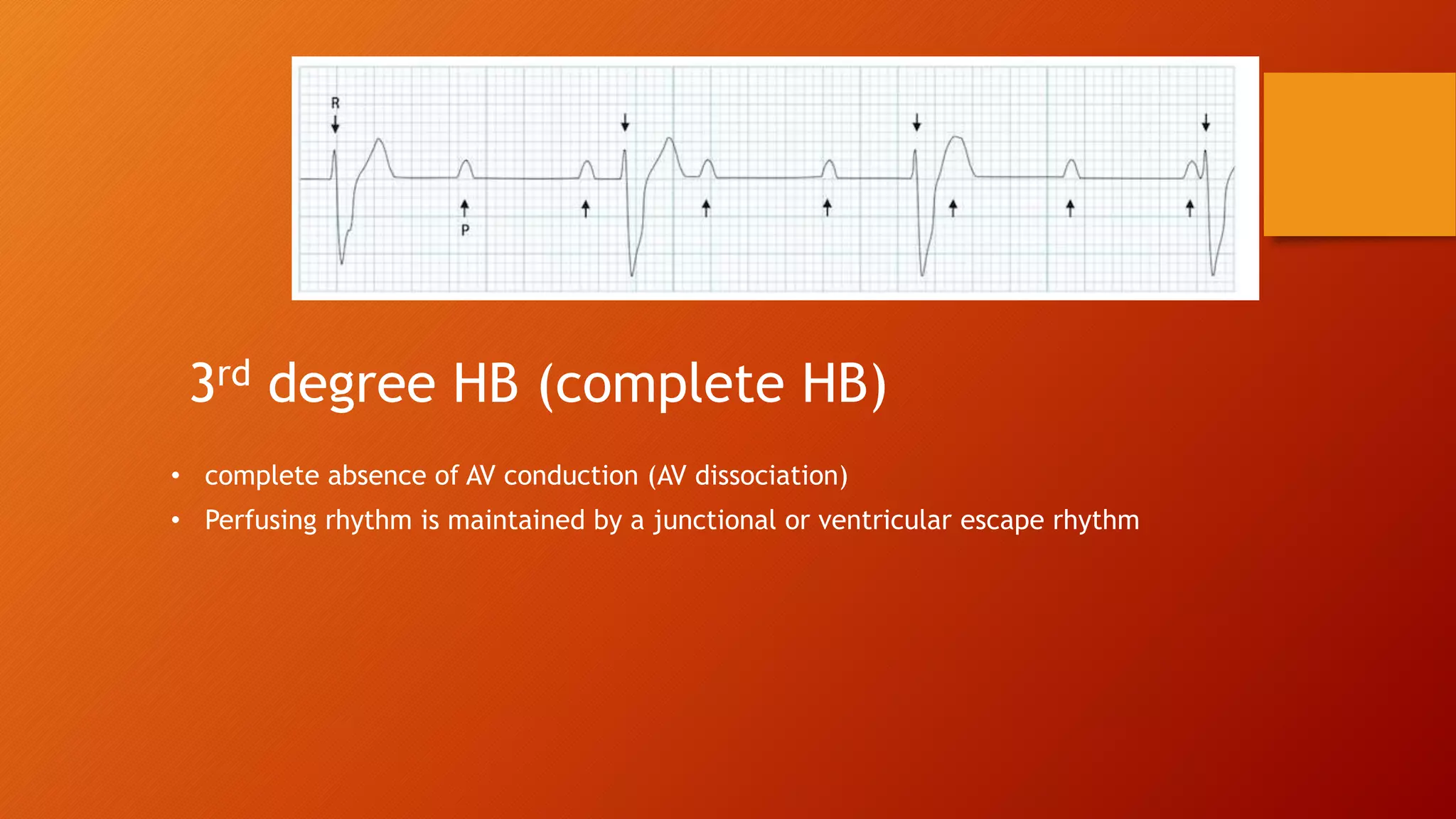 1.Rhythm Recognition.pptx