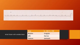 1.Rhythm Recognition.pptx