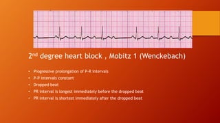 1.Rhythm Recognition.pptx
