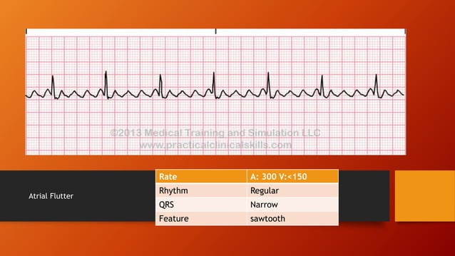 1.Rhythm Recognition.pptx