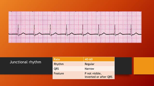 1.Rhythm Recognition.pptx