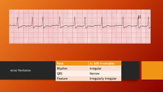 1.Rhythm Recognition.pptx