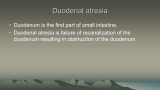 Apple Peel Atresia Usmle