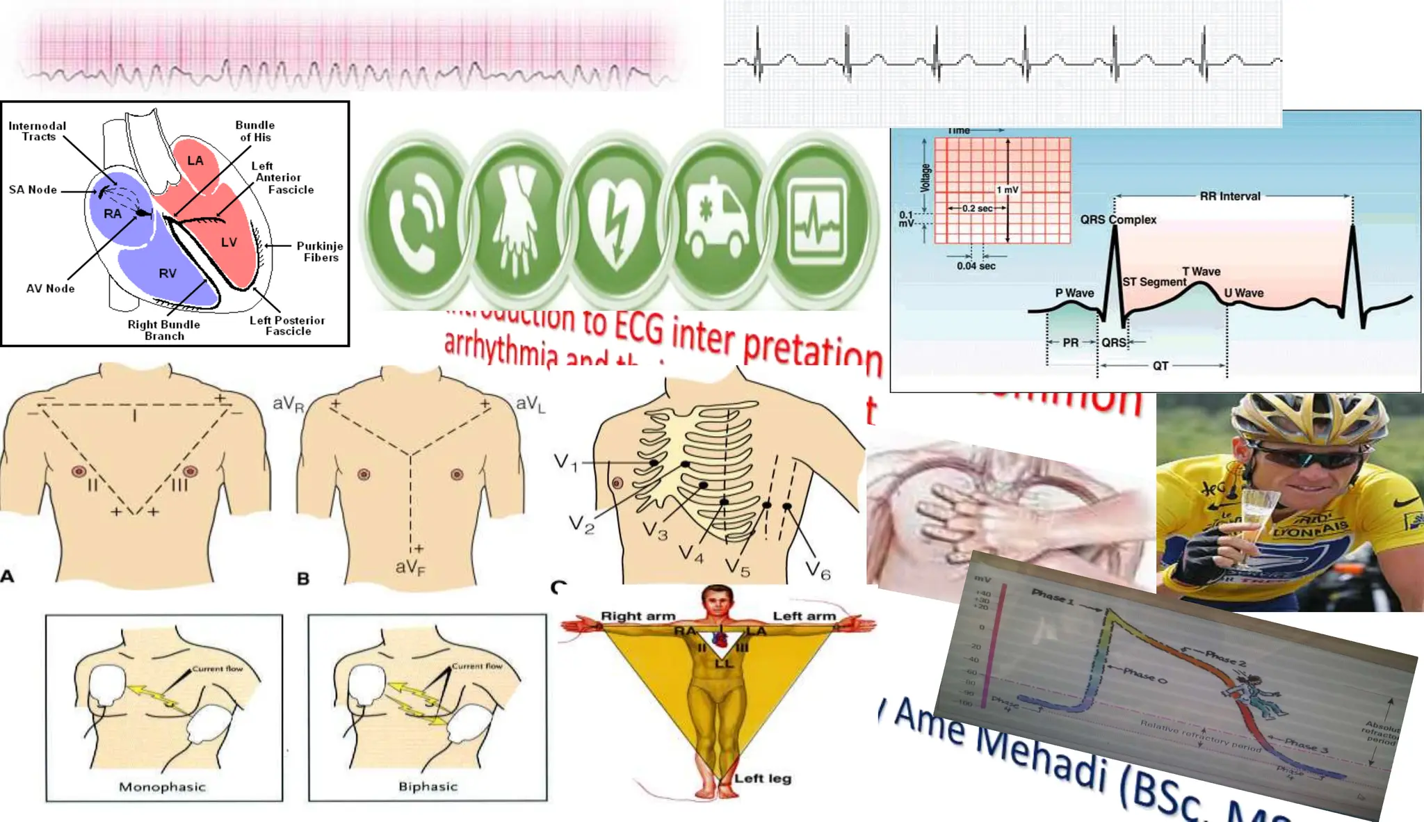 ECG For BSc Students.pptx