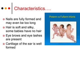 1. Characteristics of a normal newborn.pdf