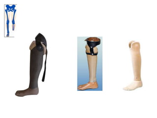 1.PROSTHETIC COMPONENTS.ppt for rehabbbx | PPTX | Foot Health ...