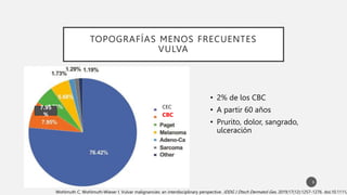Carcinoma basocelular, espinocelular y su tratamiento | PPTX