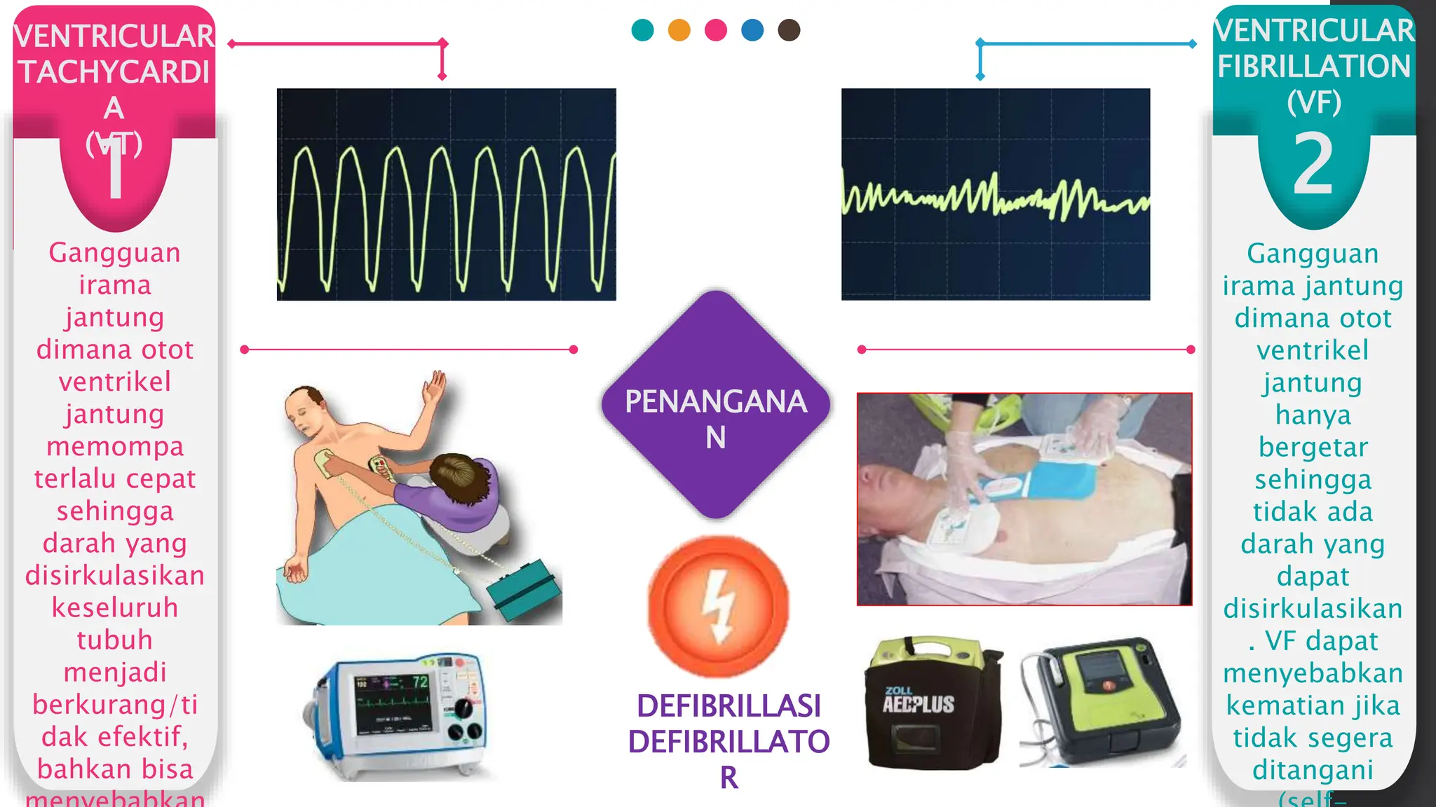1. Basic Cardiovascular, Arrythmia, CPR, Defibrillation.pptx