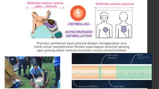 1. Basic Cardiovascular, Arrythmia, CPR, Defibrillation.pptx