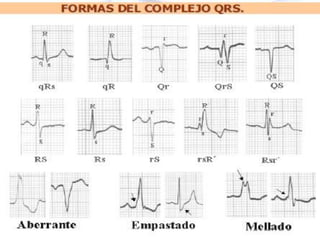 1.EKG Basico.pdf