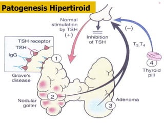 1. Hipertiroid in clinical health care.pdf