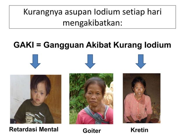 1. Pemantauan_Gangguan Akibat Kekurangan Yodium.pptx