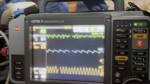 Fully Automated CPR | Jason van der Velde | TBS24 | PPT