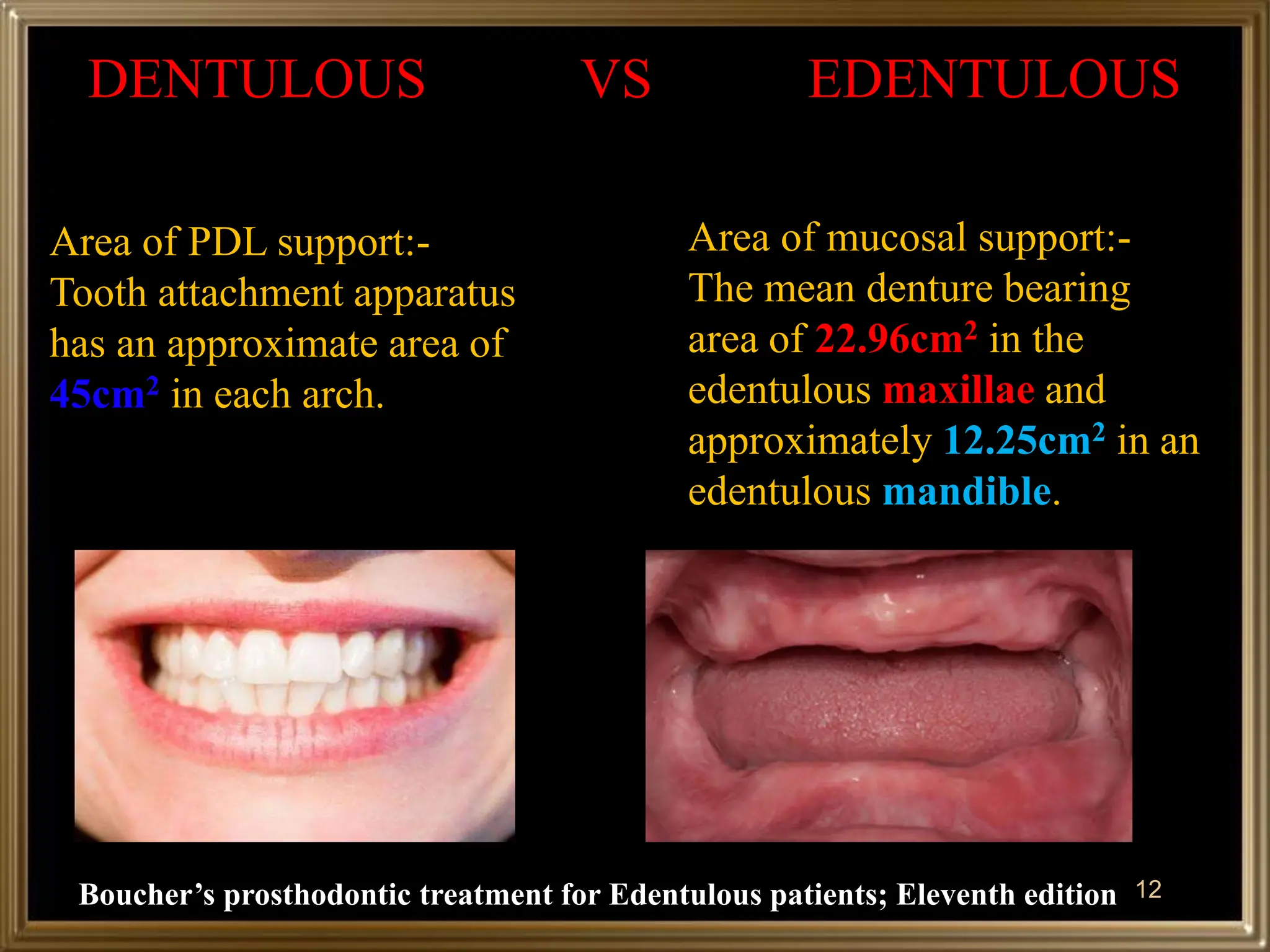 1. Biomechanics of edentulous state.pptx