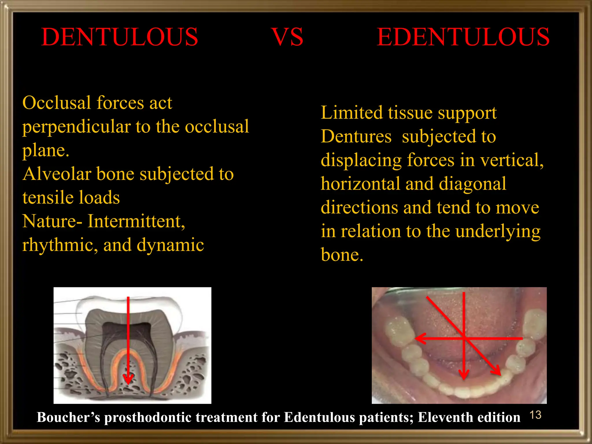 1. Biomechanics of edentulous state.pptx