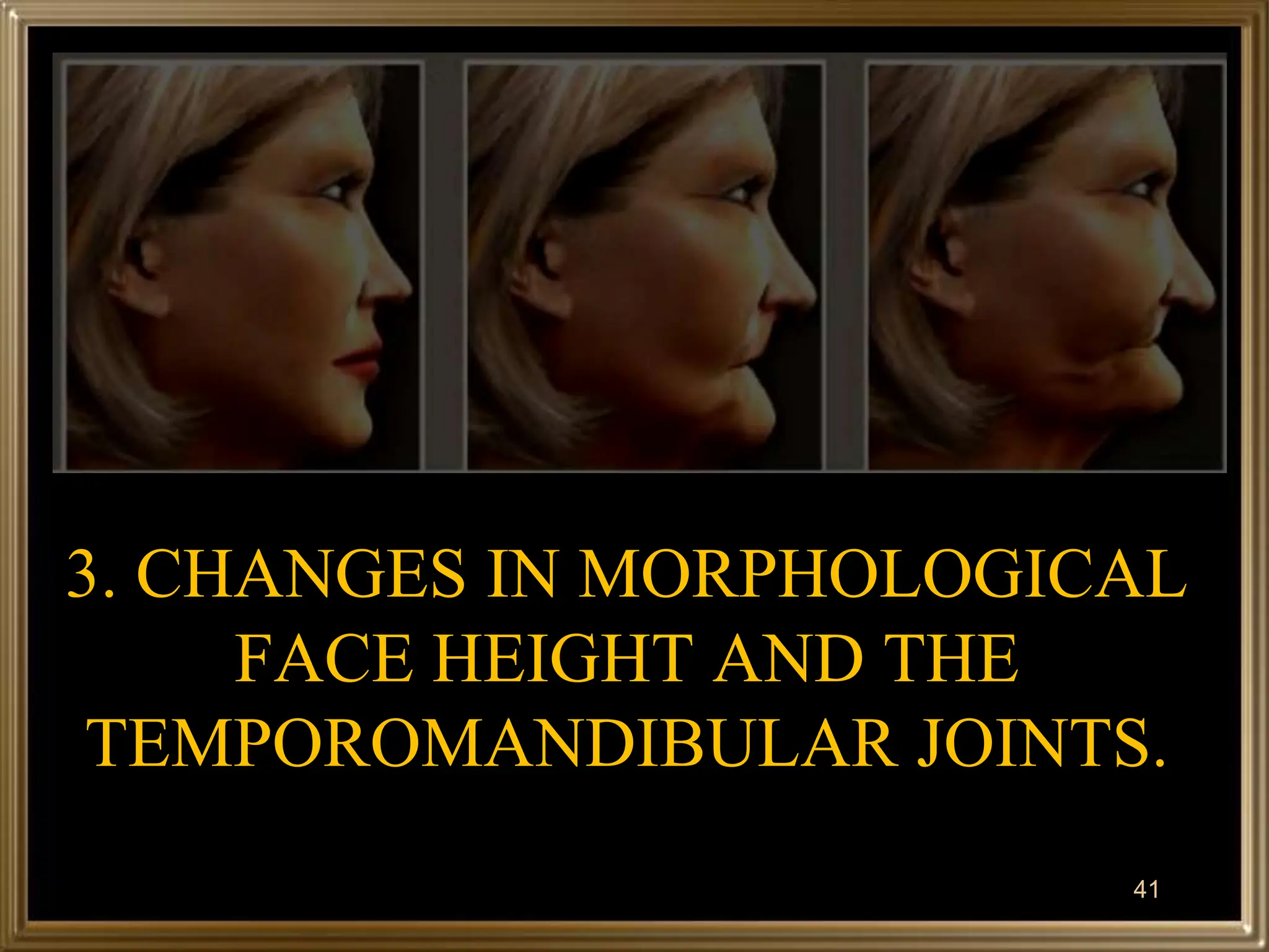 1. Biomechanics of edentulous state.pptx