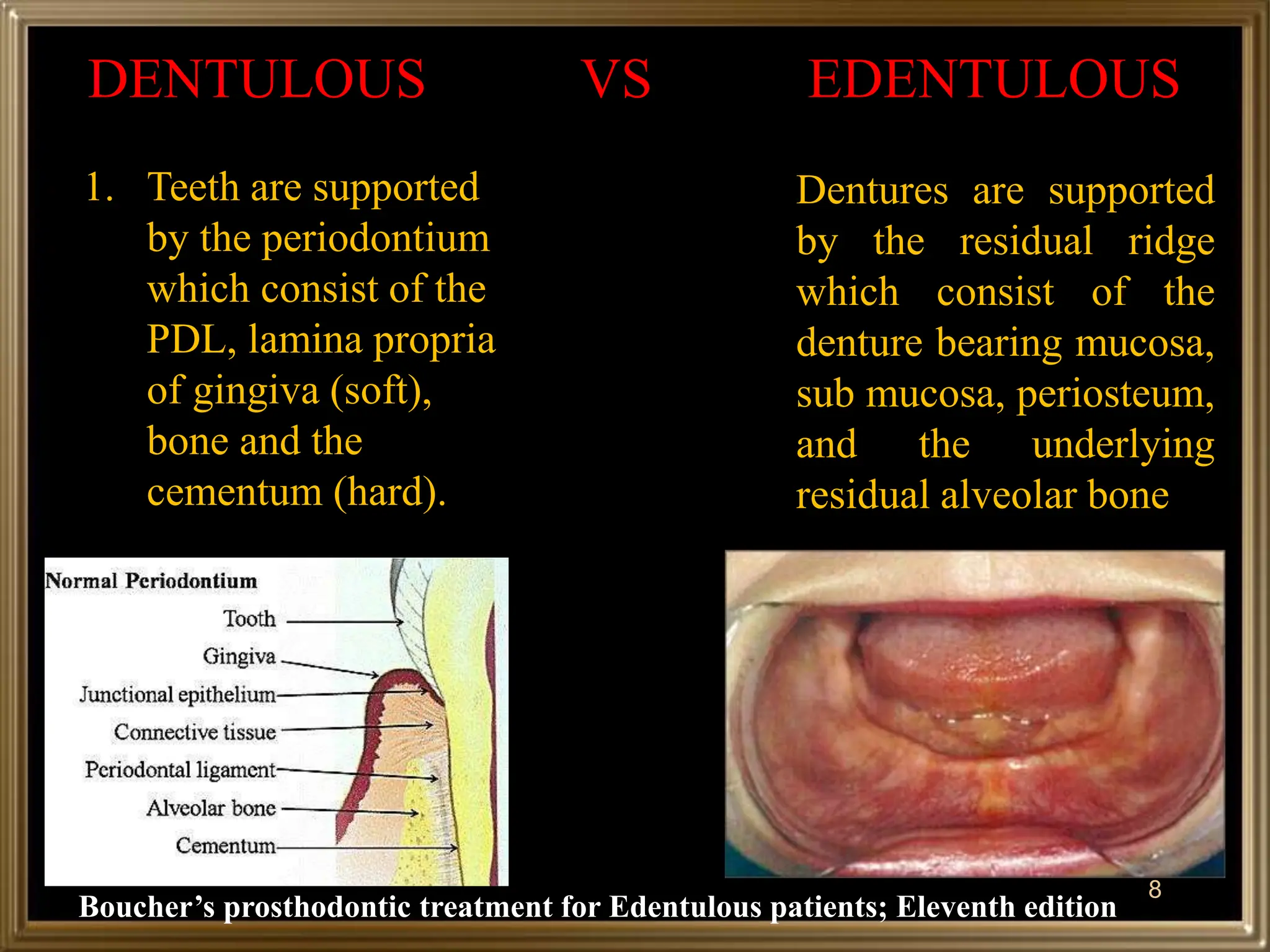 1. Biomechanics of edentulous state.pptx