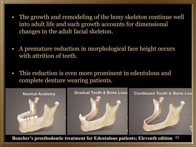 1. Biomechanics of edentulous state.pptx | Oral care | Personal Care