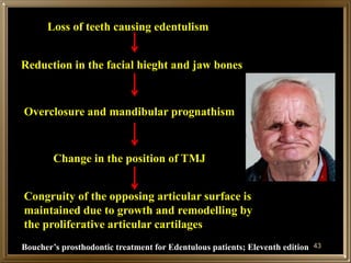 1. Biomechanics of edentulous state.pptx