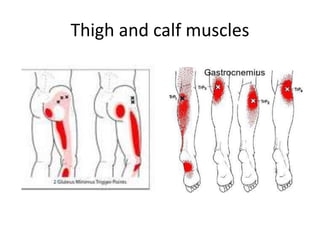 basics in dry needling and trigger points | PPTX