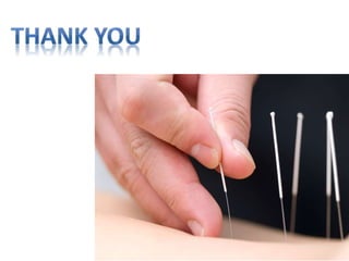 basics in dry needling and trigger points | PPTX