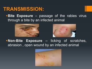 1.RABIES Awareness Presentaion powerpoint | PPTX