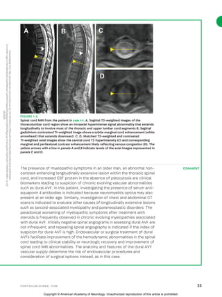 1. Clinical Approach to Myelopathy Diagnosis.pdf