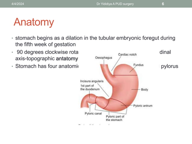 1. Surgical Management of PUDS 2020.pptx | Digestive Disorders ...