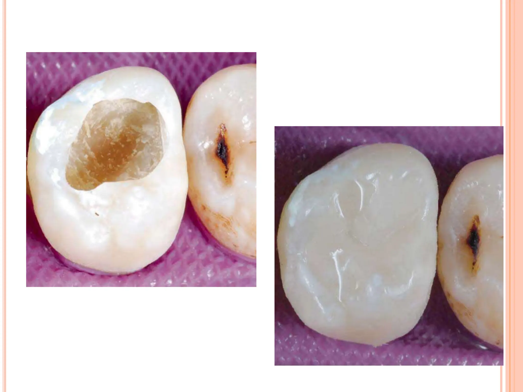 introduction of dentistry and the different specialities | PPT