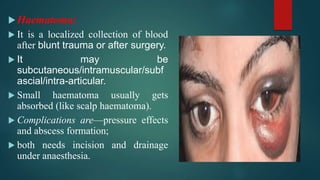 1. WOUND & WOUND HEALING III BHMS SURGERY.ppsx